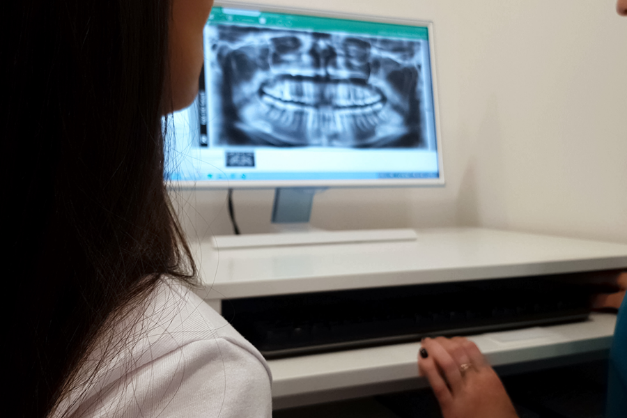 Distraction Osteogenesis in Lone Tree, CO | Rocky Mountain Surgical Arts