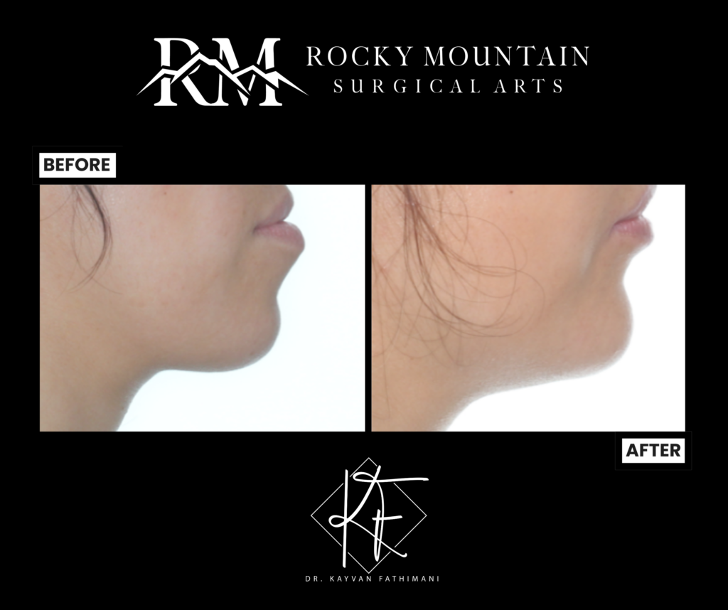 Gallery | Rocky Mountain Surgical Arts